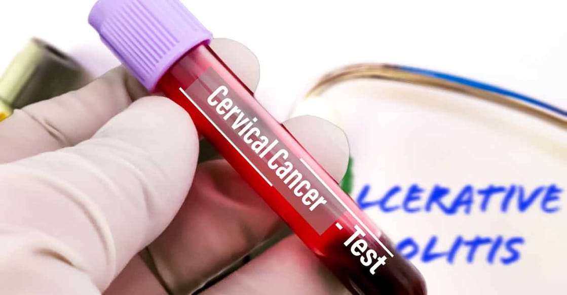 Cervical cancer: Why is the centre planning new schemes for women ...