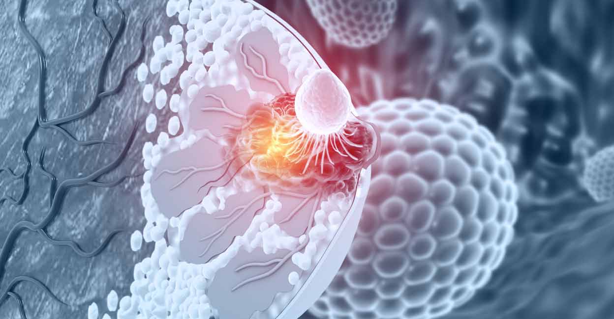 World Cancer Day: At what age are women most vulnerable to breast ...