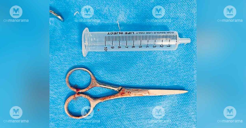 15-cm scissors lodged in patient's throat removed through surgery in ...