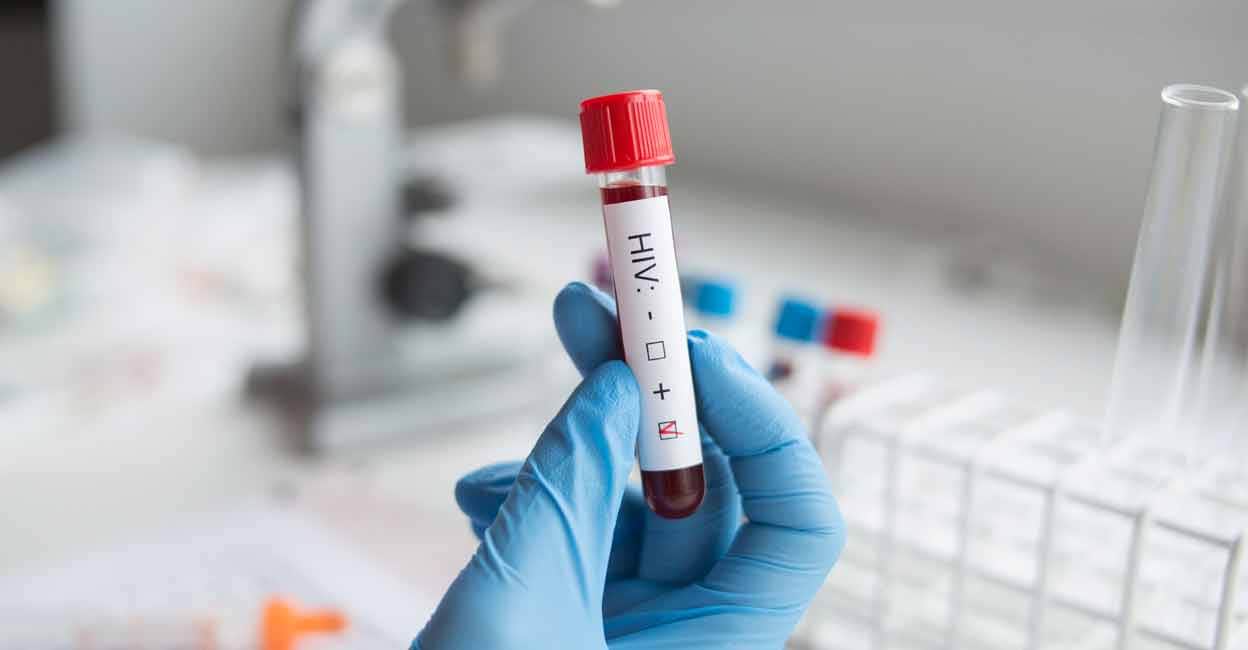 What is causing the comeback of AIDS? Solutions | Health | Onmanorama