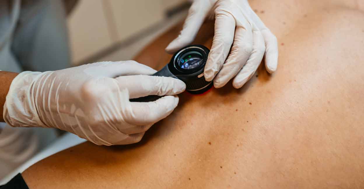 Kerala's first skin bank opens in Thiruvananthapuram, more coming ...