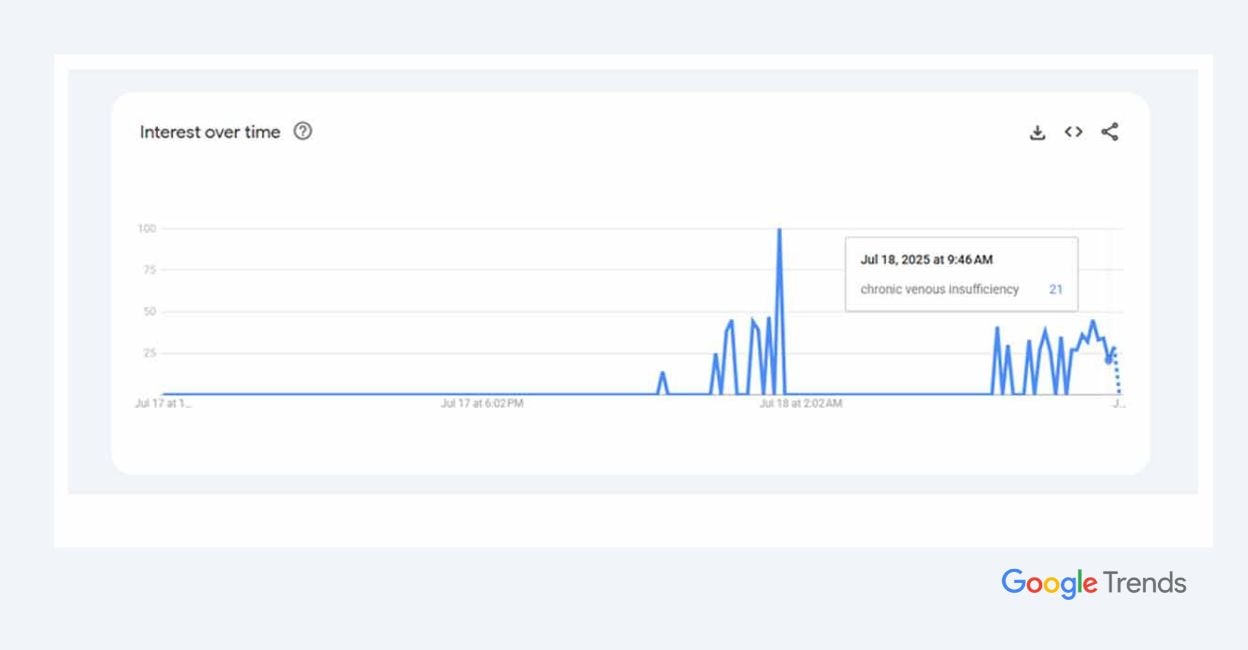 Chronic venous insufficiency: What is Donald Trump's health condition | Donald Trump | Health ...