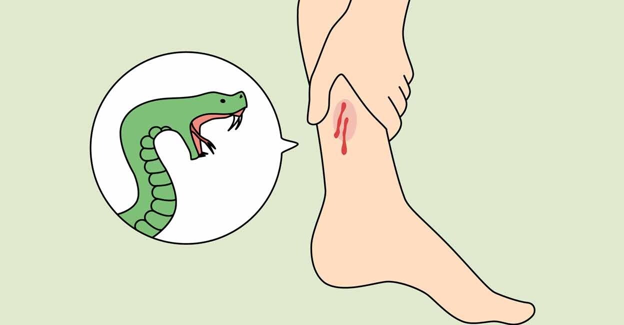 How to help a snakebite victim? Doctors explain | Health | Onmanorama