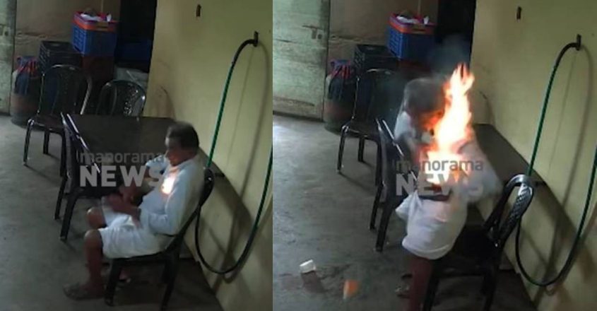 Narrow escape for Thrissur man as mobile phone explodes in his shirt pocket | Onmanorama