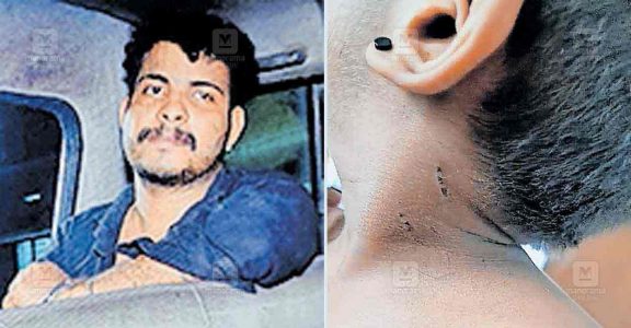 7-year-old brutally assaulted by stepfather; case against mother for ...