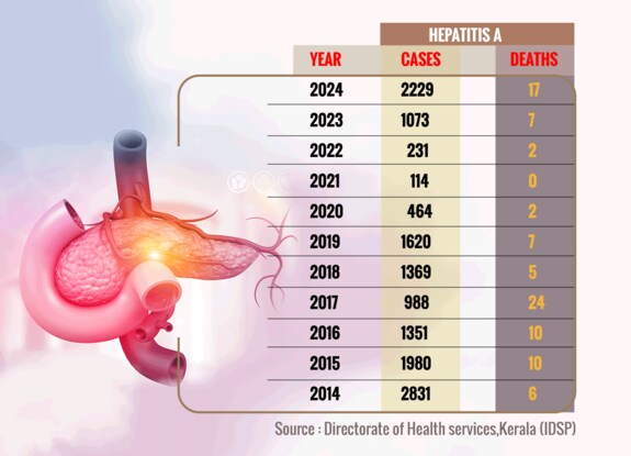 Jaundice, not dengue, second infectious cause of death in Kerala now| Onmanorama