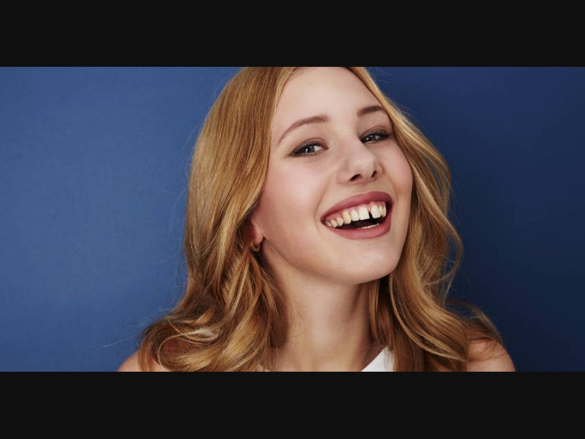 What Does A Gap In Your Front Teeth Mean Infoupdate Org
