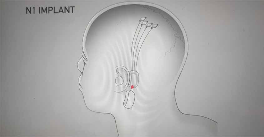Brain-on-a-chip: Elon Musk seeks human trials in 2020 | Lifestyle ...