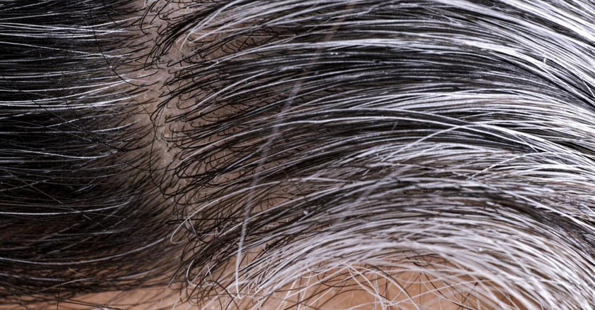 How stress can make your hair go grey