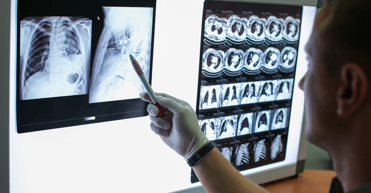 COVID-19 cases can be identified using CT scans, scientists develop AI ...