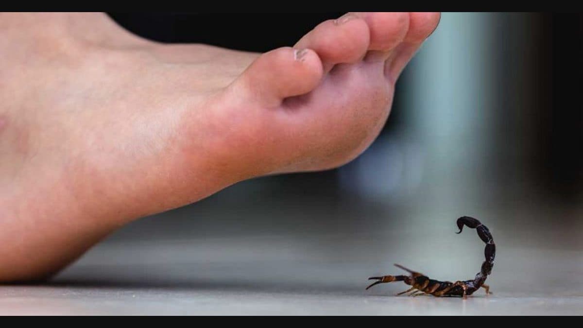 scorpion sting