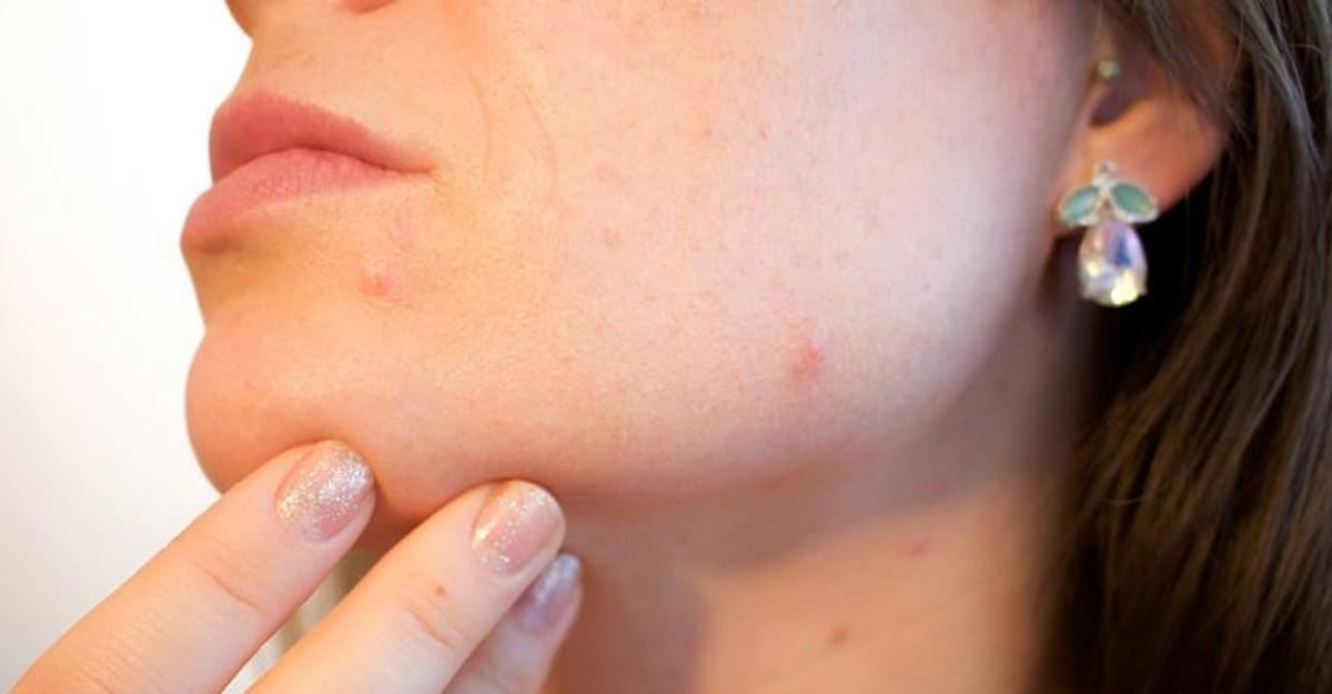 Do you detect these skin problems? Check for underlying health issues ...