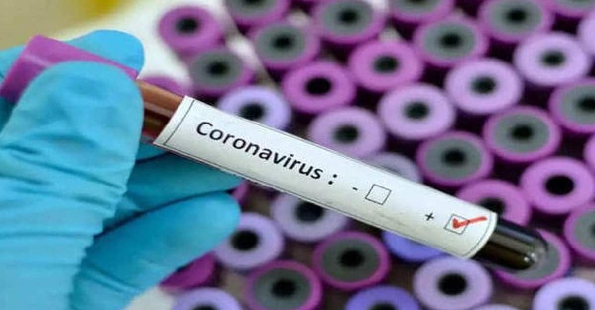 Study finds why some patients test COVID positive long after recovery ...
