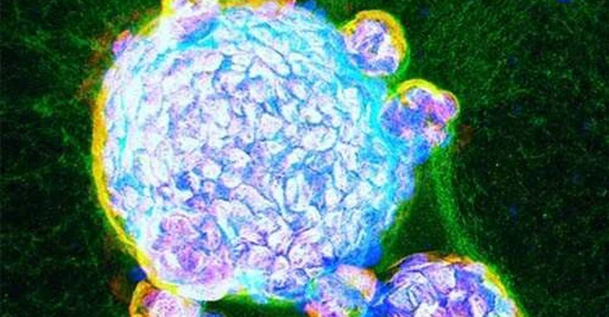 Human mini-lungs developed in lab to help new treatments for Covid ...