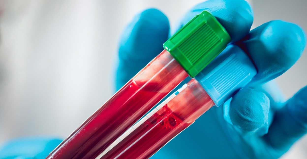 Blood test to detect anxiety? New method uses biomarkers | Lifestyle ...