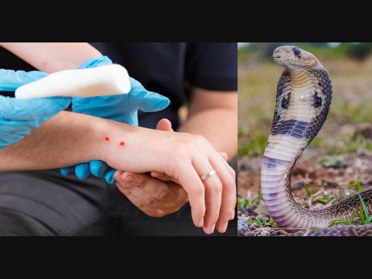 First Aid In Snake Bite: मानसून में सांप ने काटा? डरें नहीं, हॉस्पिटल ...