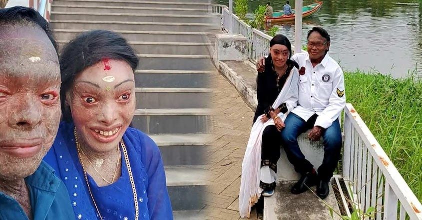 Love in the time of Lamellar Ichthyosis: How fate united Sivan, Salini ...