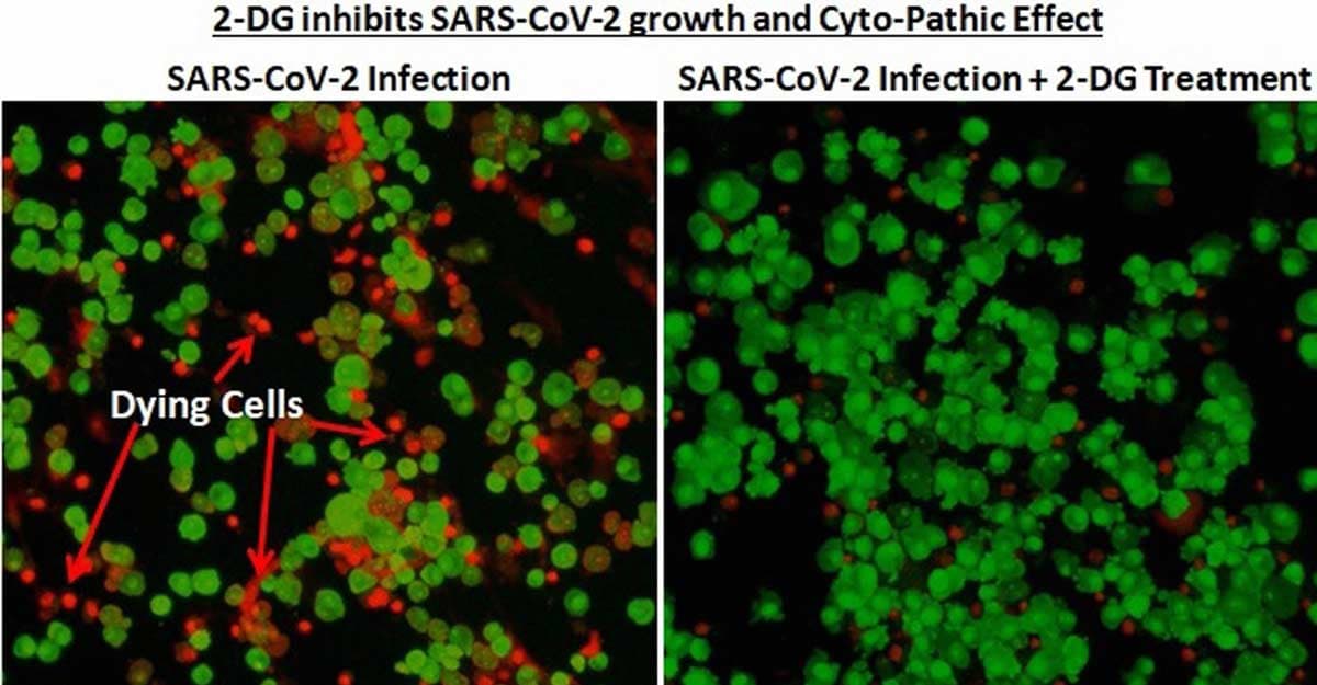 DCGI approves anti-COVID drug developed by DRDO for emergency use ...