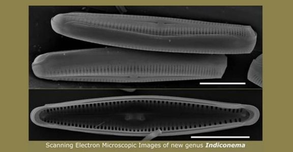 Diatoms | Algae