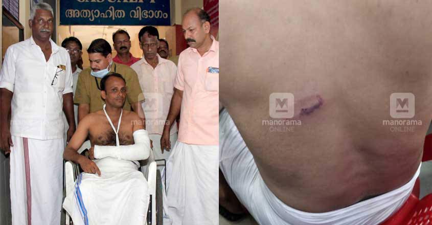 Cops baton-charge CPI protest march, break MLA Eldho's arm | Kerala ...