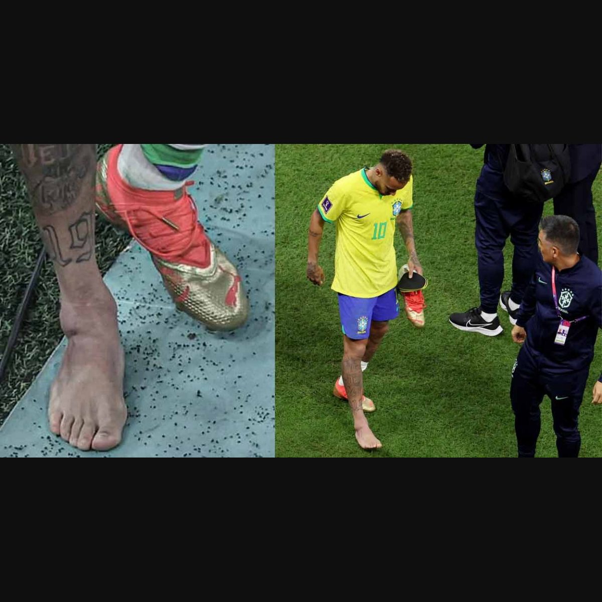 neymar feet bleeding