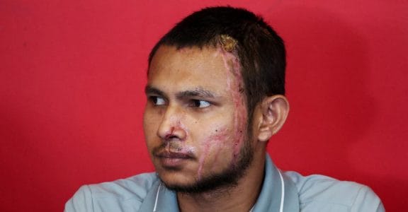 Malaysian footballer Faisal Halim calls for justice after acid attack ...