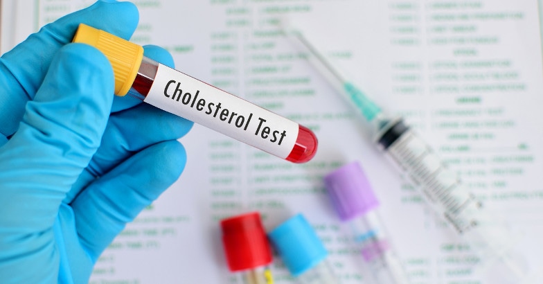 Everyday Health | Getting to know the Cholesterol family